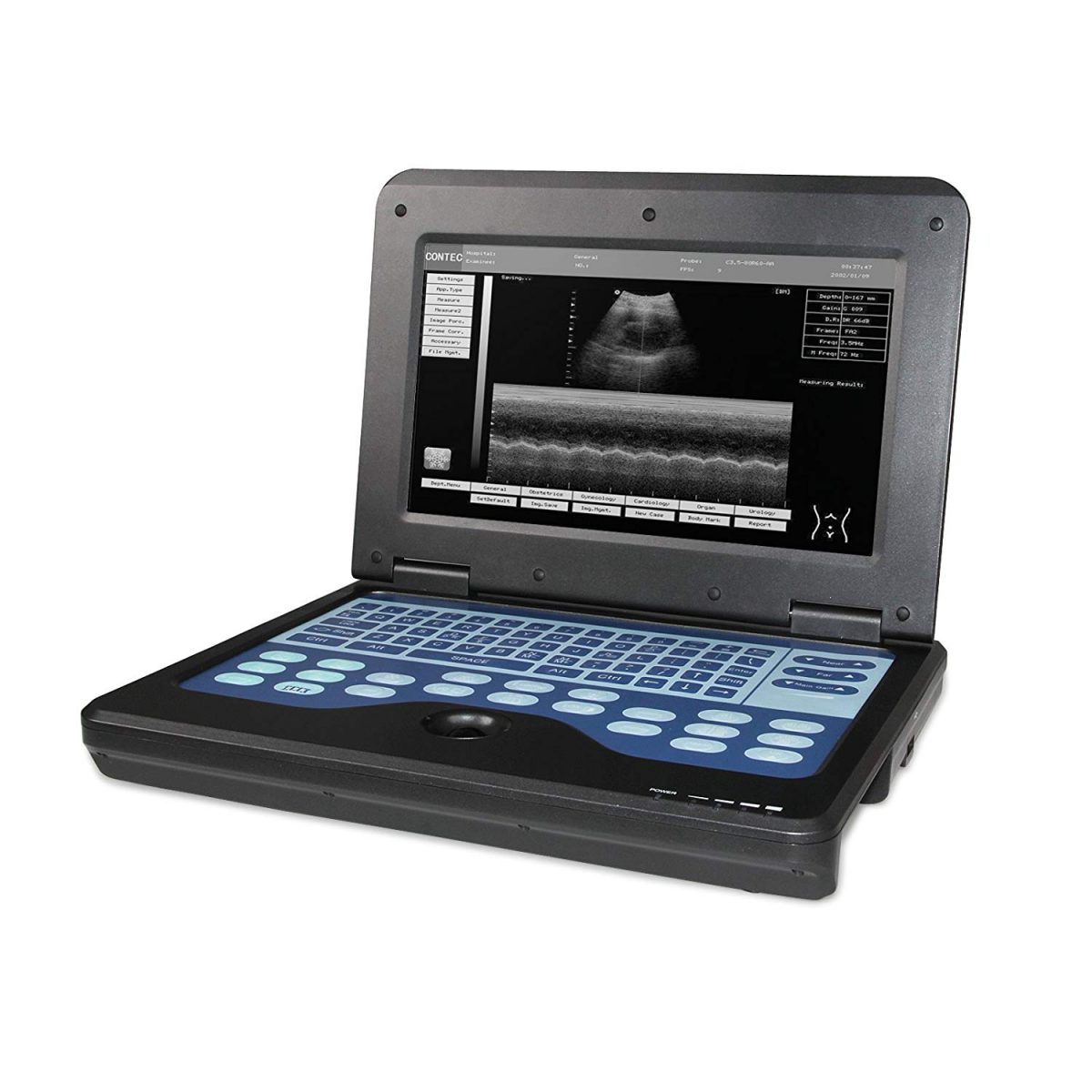 Contec Portable Veterinary Ultrasound Scanner - GM Medical - Kenya